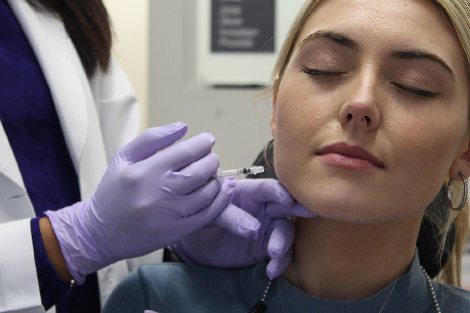 Botox - Rittenhouse Dentists